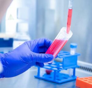 Primary Samples from Hematological Malignancies - Diag2Tec ...